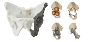 Powder Technology Innovation - Adler Ortho