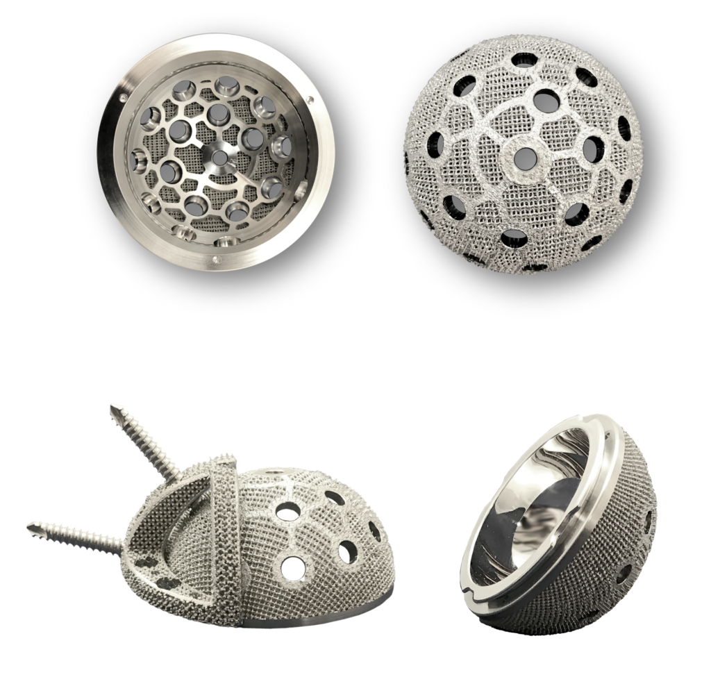 Aurea : Hip Prostheses - Adler Ortho